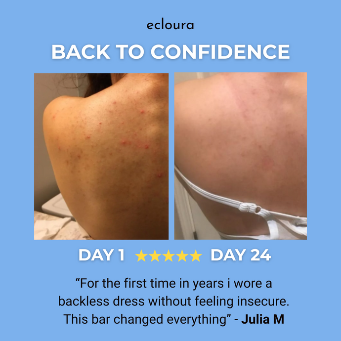 Bacne Out Bar™ – Ecloura