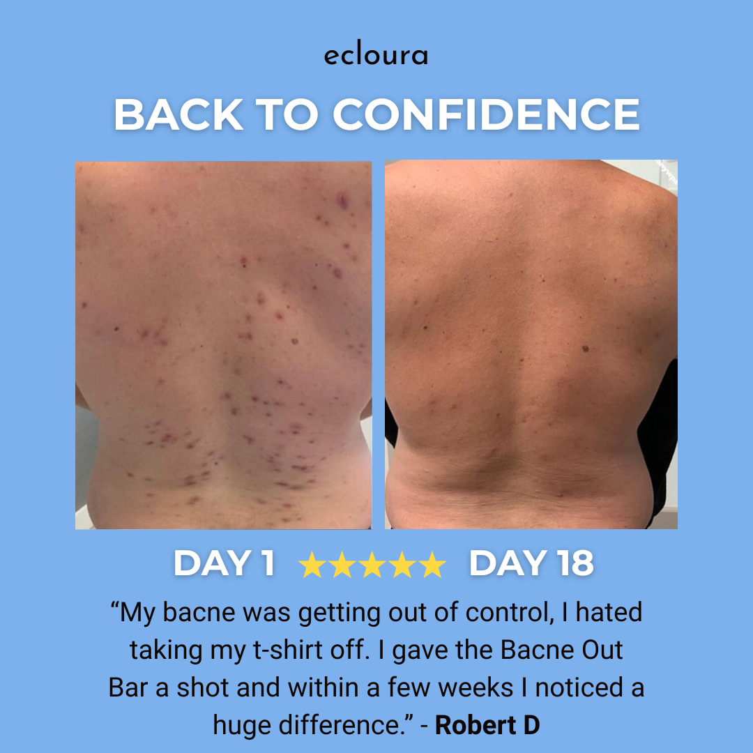 Bacne Out Bar™ – Ecloura